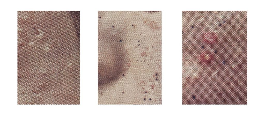 1.2 Skin Analysis – Barbering Techniques for Hairstylists