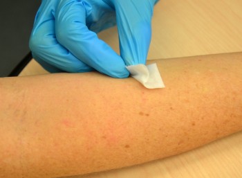 7.3 Intradermal and Subcutaneous Injections – Clinical Procedures for ...