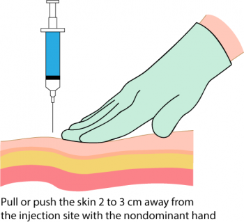 7.4 Intramuscular Injections – Clinical Procedures for Safer Patient Care