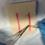 4.4 Suture Removal – Clinical Procedures for Safer Patient Care