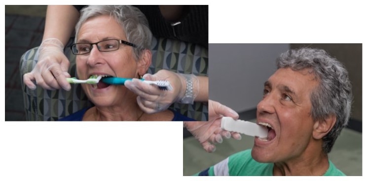 4.2 Oral Hygiene – Personal Care Skills for Health Care Assistants