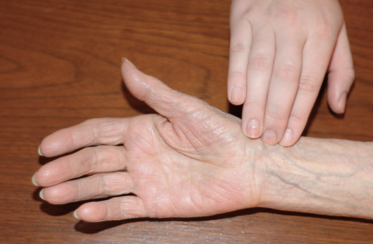 9.7 Pulse – Personal Care Skills for Health Care Assistants – 2nd Edition