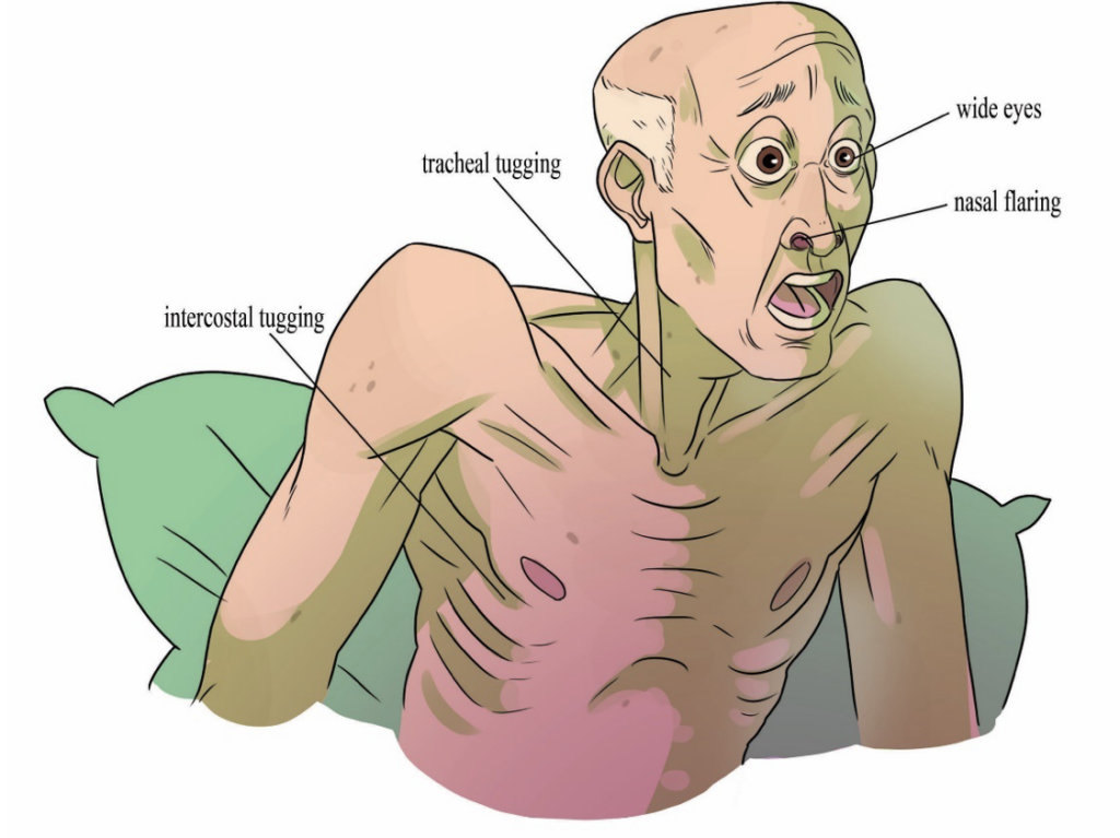 9.8 Respiration – Personal Care Skills for Health Care Assistants